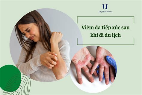 Vi M Da Ti P X C Sau Khi I Du L Ch Dr Th P Long