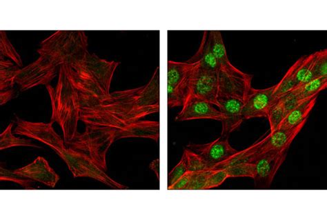 Dna Damage Antibody Sampler Kit Cell Signaling Technology