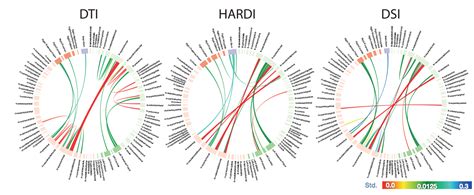 Brain Connectomics Modeling Disconnection Syndrome In Multiple Sclerosis Fp7 Cordis