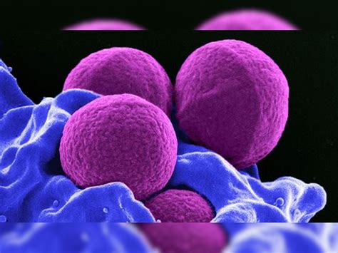 Know Here What Is Superbug Why Is Killing Millions Superbug सुपरबग ने मचा रखी है तबाही लाखों