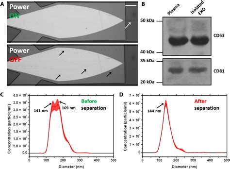 Focusing Type Separation Of Exosomes From Patient Plasma A Stacked Download Scientific