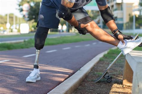 Above Knee Amputation Recovery And Rehabilitation 2025 Guide