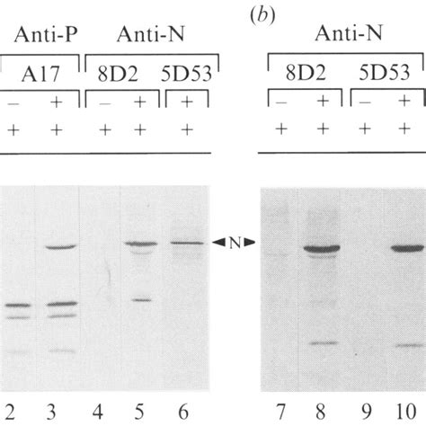 Schematic Representation Of The Truncated P Proteins Dark Bars Download Scientific Diagram