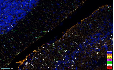 Unraveling Brain Heterogeneity Exploring Cellular Diversity And