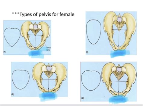 Types Of Pelvis For Female Quiz