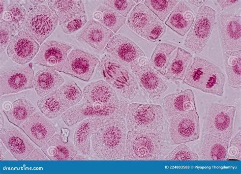 Mitosis Cell In The Root Tip Of Onion Under A Microscope Stock Image CartoonDealer Com