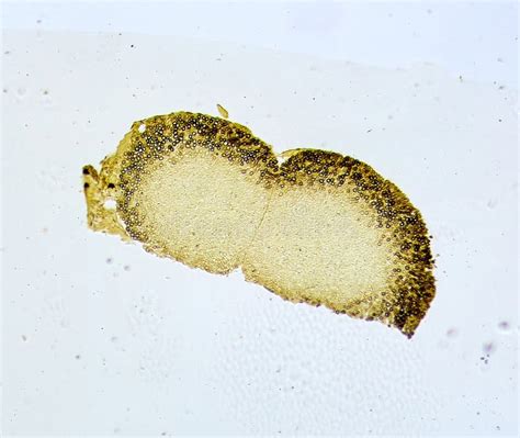 Life Under A Microscope Stock Image Image Of Micro 308361167