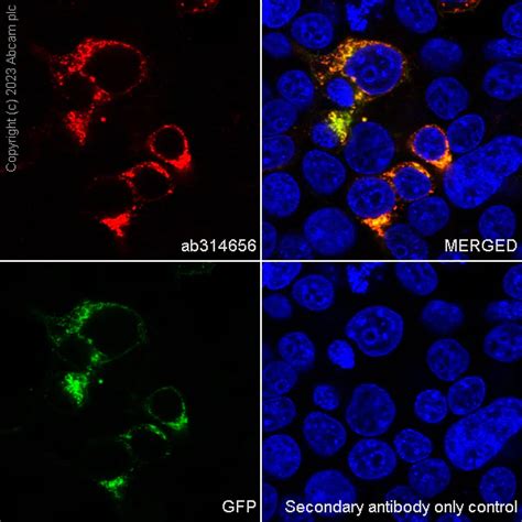 Anti Gfp Antibody Epr28018 38 Rabbit Monoclonal Ab314656 Abcam