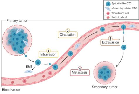 Rôle Des Ctcs Dans La Formation De Métastases Détachement Des Ctcs De