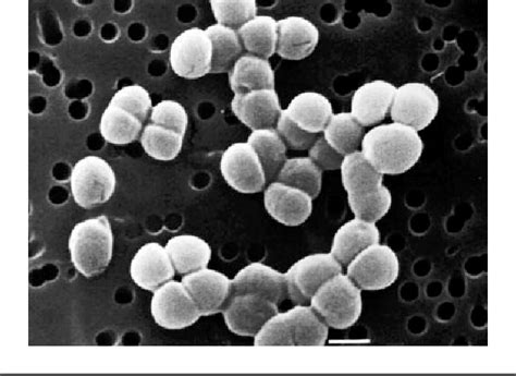 Halococcus Dombrowskii
