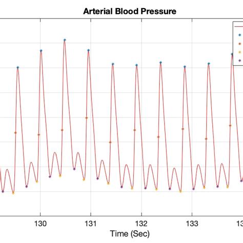 The Detection Of Ppg Feature Points Download Scientific Diagram