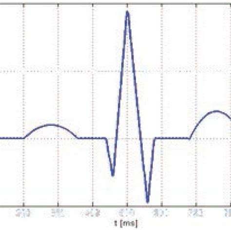 Decomposition Of The Ecg Signal Download Scientific Diagram