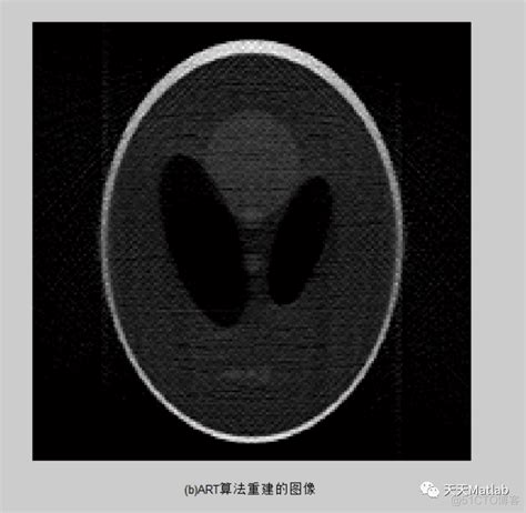 【图像处理】基于art算法实现图像重建matlab源码51cto博客matlab 图像处理算法