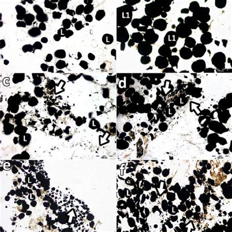 Photomicrographs Of Osmium Tetroxide Stained Sections Of Iat Showing