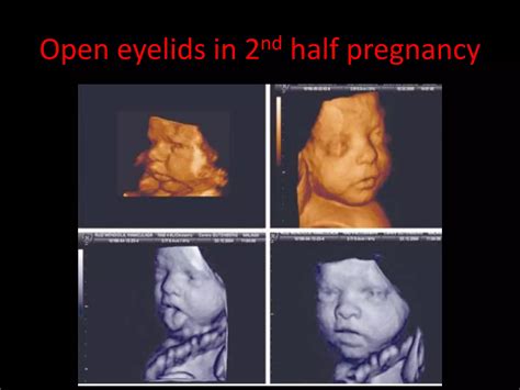 5 Fetal Face Ultrasound Dr Ahmed Esawy Pdf