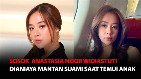 Sosok Selebgram Anastasia Noor Widiastuti, Diduga Dianiaya Mantan Suami Saat Temui Anak - YouTube