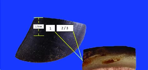 Scheme Showing The Collection Site And The Fragment Collected For Download Scientific Diagram