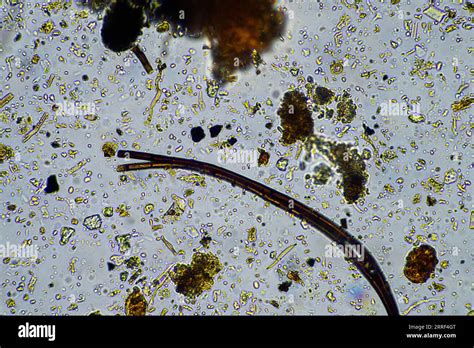 Soil Life Under The Microscope With Soil Fungi And Fungal Hyphae On A