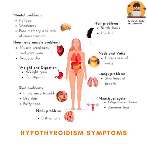 Hypothyroidism Hashimotos Thyroiditis
