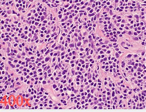 Histopathological Findings At Lesion Excision In April 2021 Staining Download Scientific