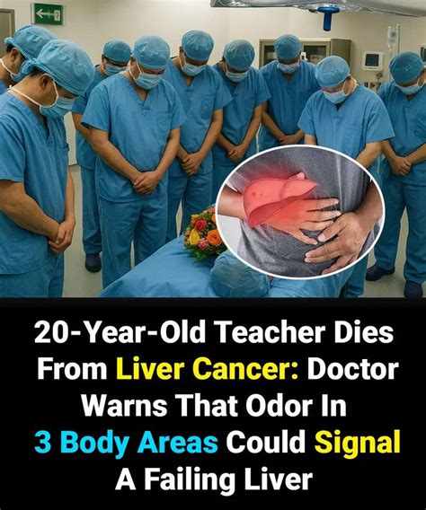 20 Year Old Teacher D Ies From Liver C A Ncer Doctor W Ar Ns That Odor