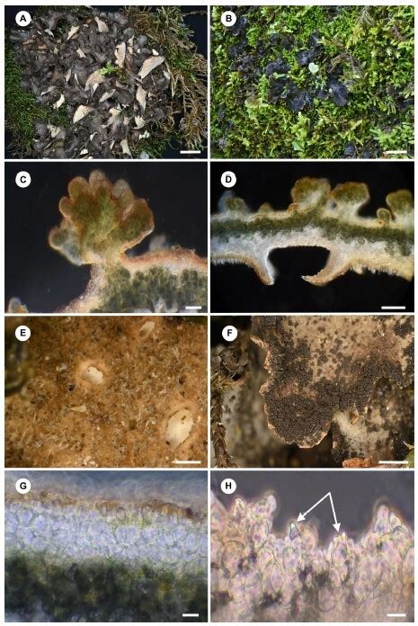 Sticta Puebloensis Lichenized Ascomycota Peltigeraceae A New