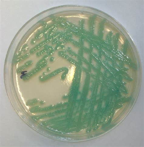 Appearance Of Mdrab On A Chromagar Acinetobacter Plate Download