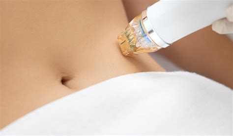 Secret RF Microneedling Dubai Best Skin Rejuvenation Treatment