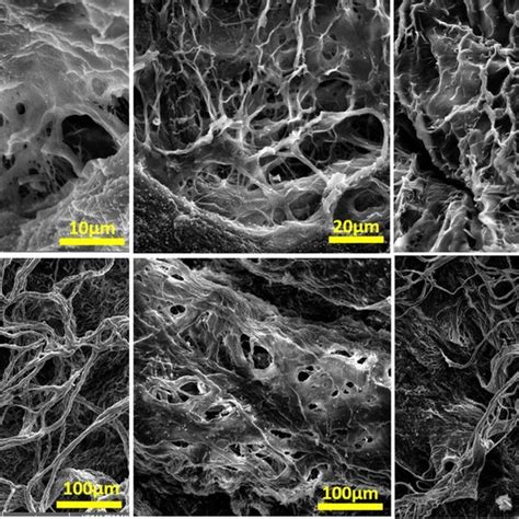 Sem Assessment Showed Ultra‐architecture Of The Decellularized Tissues Download Scientific