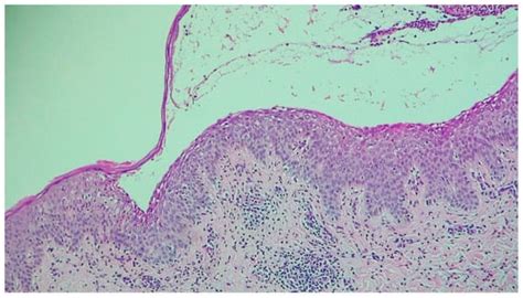 Dermato An Open Access Journal From Mdpi