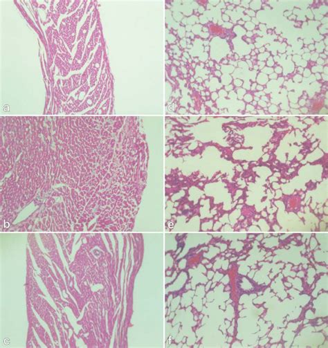 Right Ventricular Wall Of The Heart And Section Of Lung At The End Of