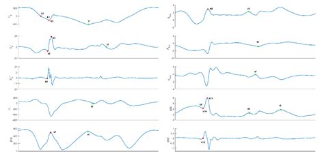 Figure 2 From Accurate Estimation Of Running Temporal Parameters Using