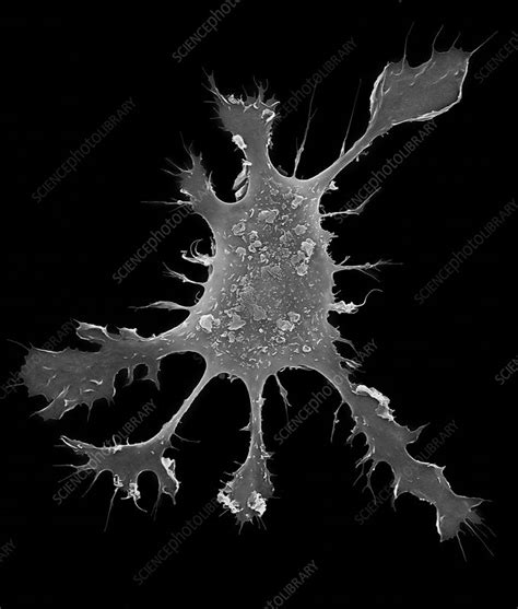 Human Dendritic Cell Sem Stock Image C036 9847 Science Photo Library