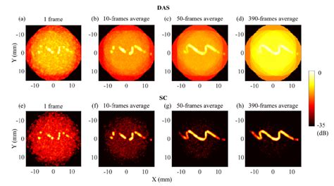 Maximum Intensity Projection Onto The Xy Plane Beamformed Using A D
