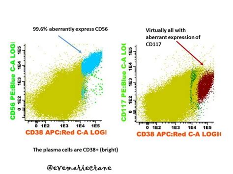 Myeloma Immunophenotyping