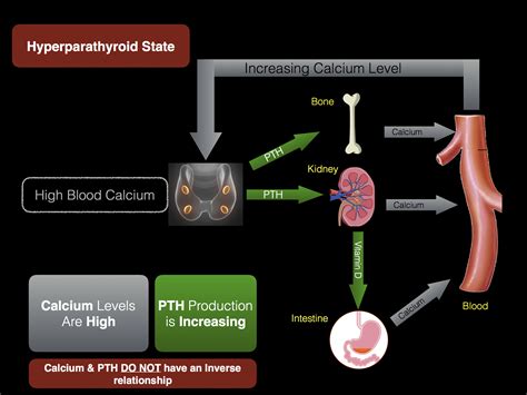 Hyperparathyroidism Diagnosis For Parathyroid Disease Dr Larian