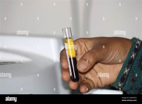 Semi Auto Chemistry Analyzer Hi Res Stock Photography And Images Alamy