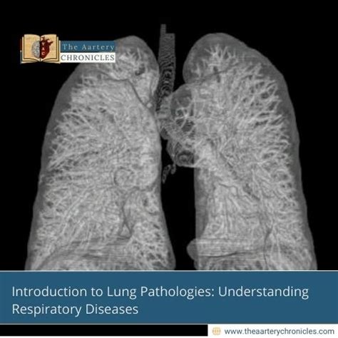 Introduction To Lung Pathologies Understanding Respiratory Diseases