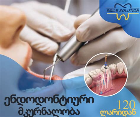 Smile Solution • 24 საათიანი სტომატოლოგიური კლინიკა Tbilisi
