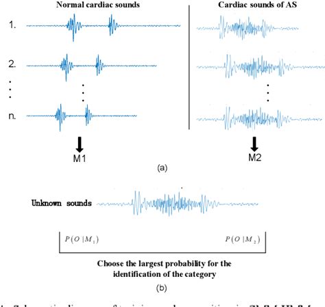 Figure 1 From Machine Learning Based Aortic Stenosis Detection For