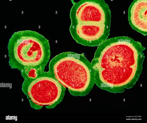 Mrsa Resistant Staphylococcus Bacteria Coloured Transmission Electron Micrograph Tem Of A