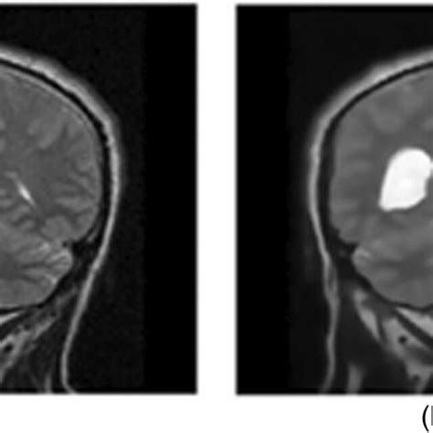 Structure Of The Proposed Cnn‐svm Model Cnn Convolutional Neural