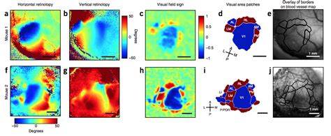 About — Retinotopicmapping 100 Documentation