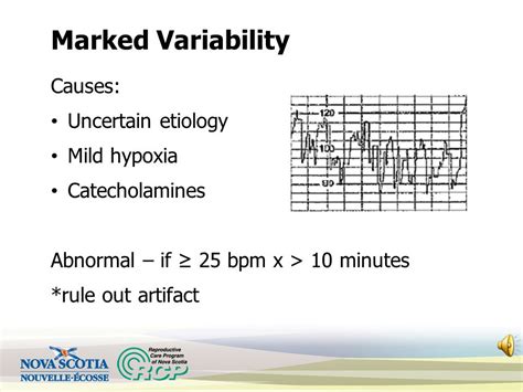 Fetal Health Surveillance Fhs Part 2 Electronic Fetal Monitoring