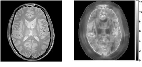Figure From MRI Reconstruction From Sparse K Space Data Using Low Dimensional Manifold Model