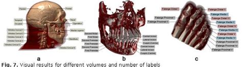 Table 1 From Real Time External Labeling Layout Algorithm For Direct Volume Rendering Semantic