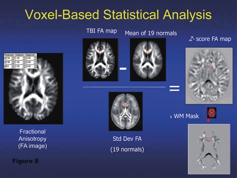 Schematic Of Voxel Based Statistical Analysis Patients Spatially
