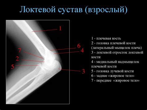 Снимок локтевого сустава - презентация онлайн