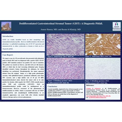 Pdf Dedifferentiated Gastrointestinal Stromal Tumor Gist A