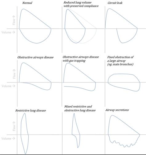 Volume Flow Loops Explained At Julie Neel Blog